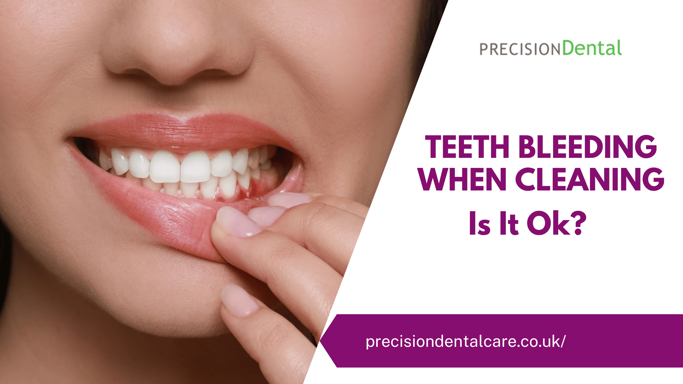 Teeth Bleeding When Cleaning, Is It Ok? - Precision Dental Care